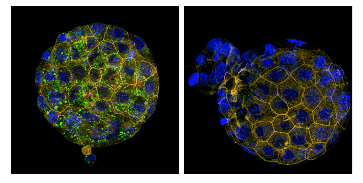 Čeští vědci na stopě příčin lidské neplodnosti | Lékařská fakulta v Plzni